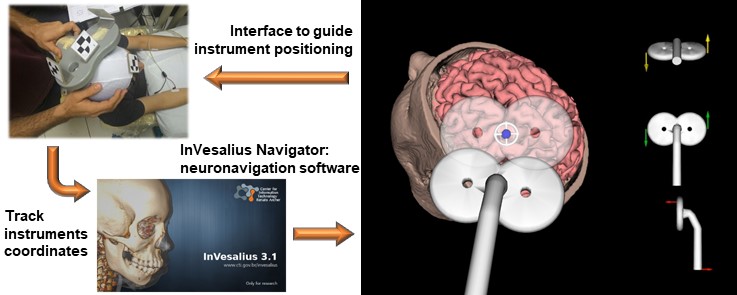 Development and characterization of the InVesalius Navigator software ...